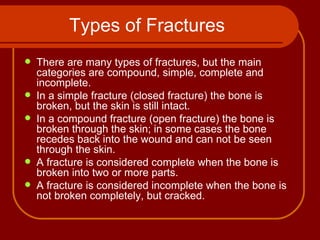 Understanding Fractures | PPT