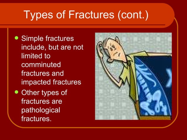 Understanding Fractures | PPT