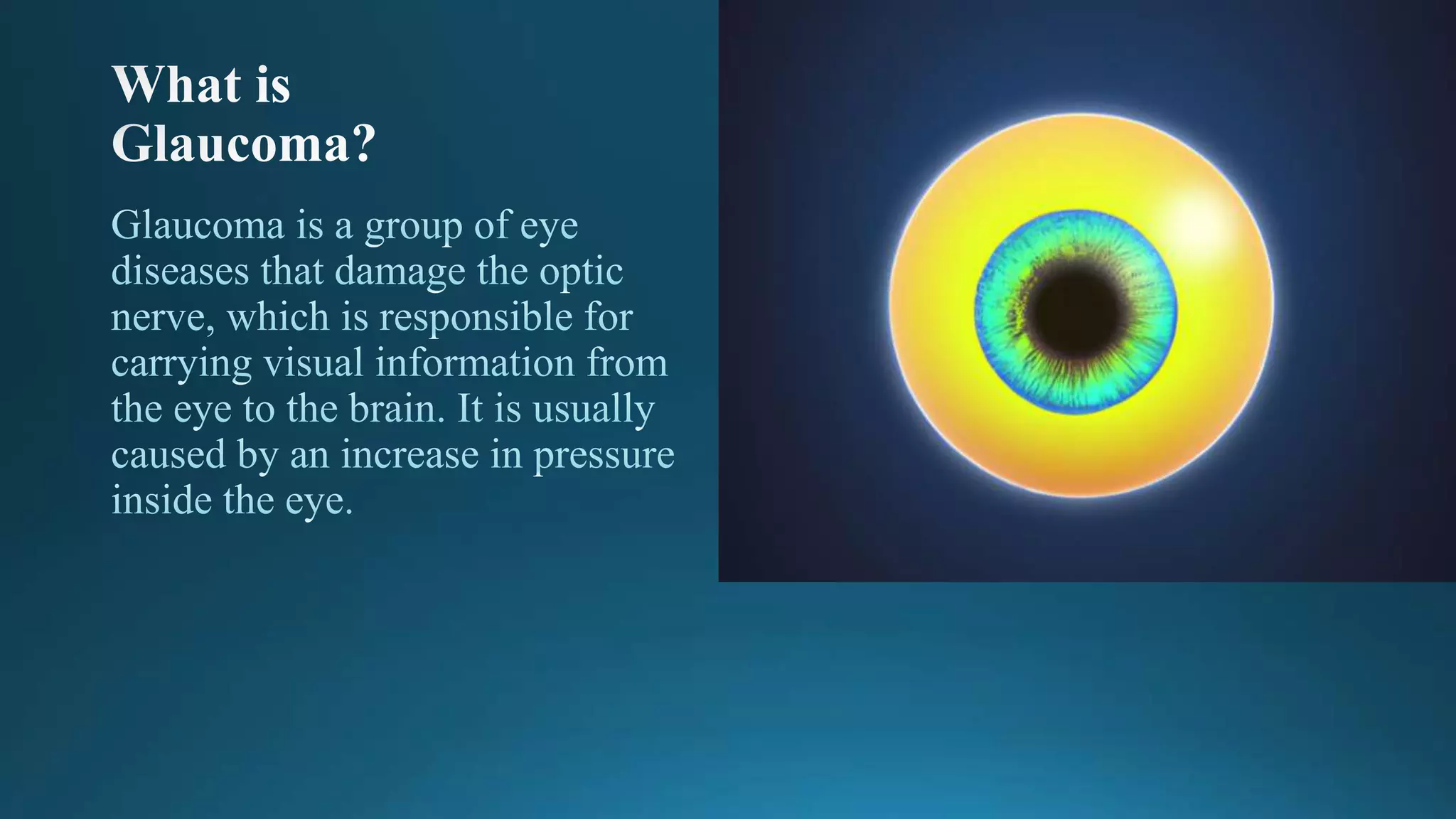 Understanding Glaucoma | PPT
