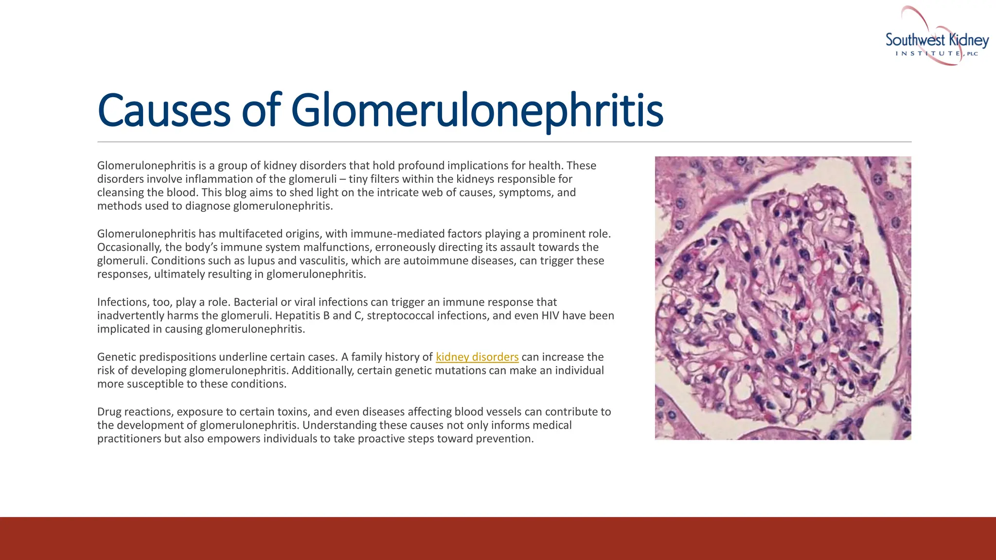 Understanding Glomerulonephritis Causes, Symptoms, and Diagnosis.pptx