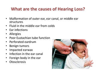 Understanding Hearing Loss | PPT