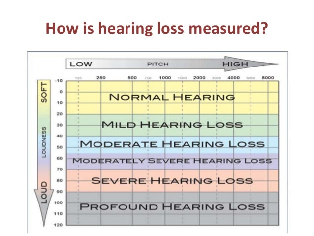 Understanding Hearing Loss