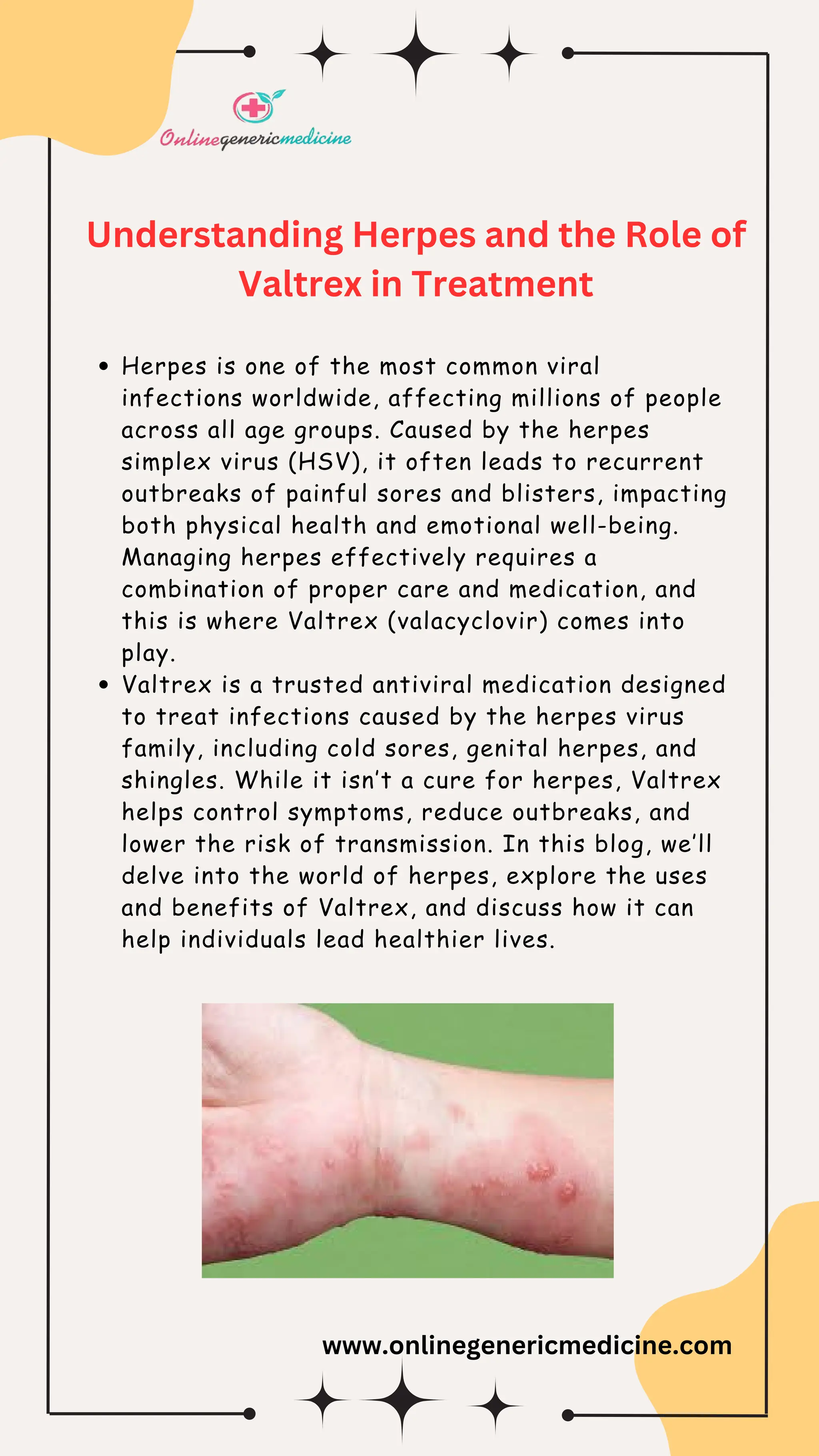 Understanding Herpes and the Role of Valtrex in Treatment.pdf