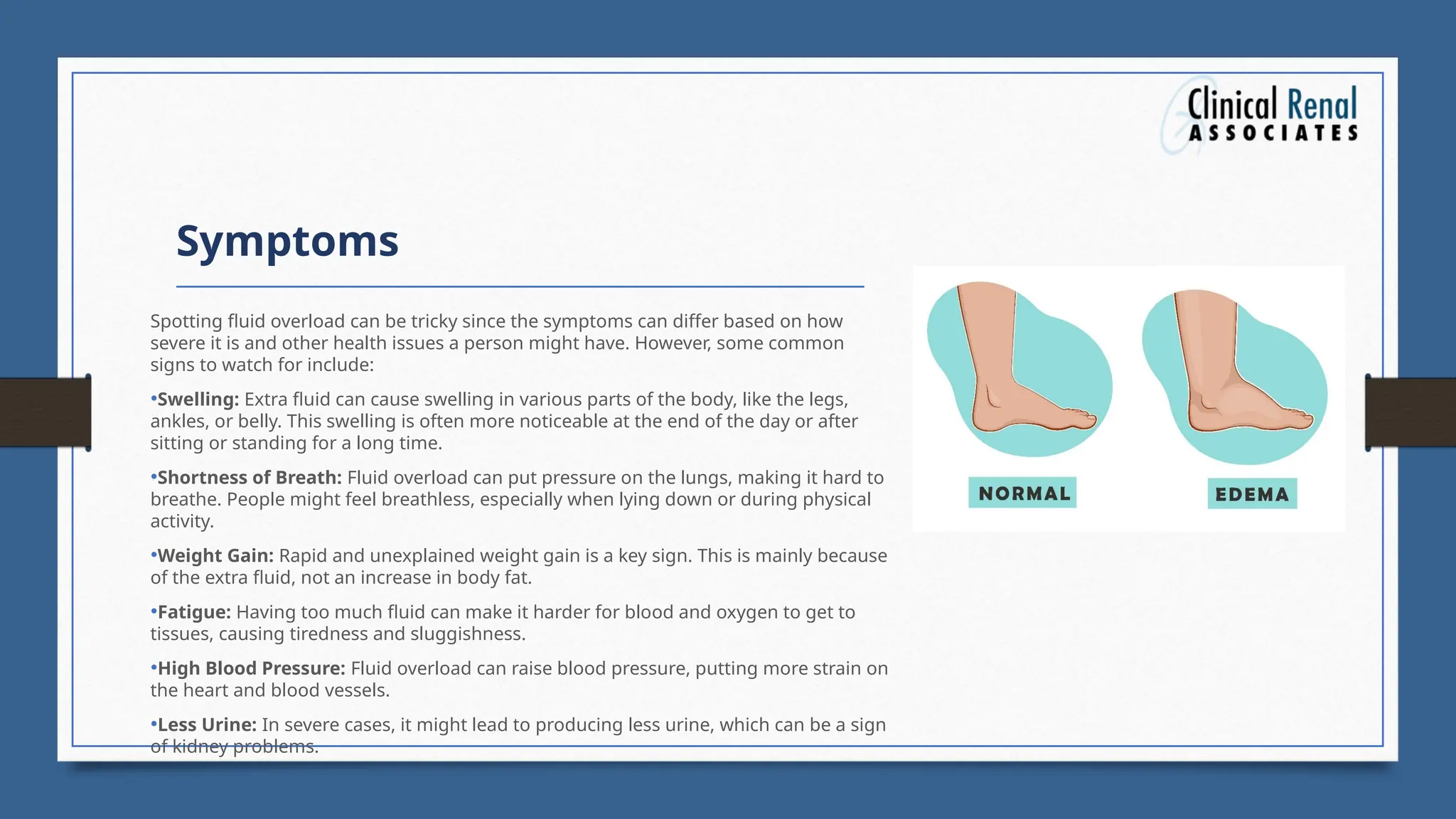 Understanding Hypervolemia Symptoms, Causes, Diagnosis, and Management.pptx