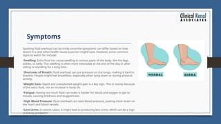 Understanding Hypervolemia Symptoms, Causes, Diagnosis, and Management.pptx