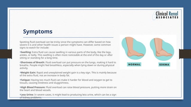Understanding Hypervolemia Symptoms, Causes, Diagnosis, and Management.pptx