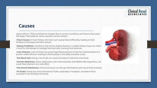 Understanding Hypervolemia Symptoms, Causes, Diagnosis, and Management.pptx
