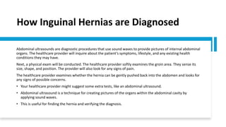 Understanding Inguinal Hernia - Complete Overview.pdf