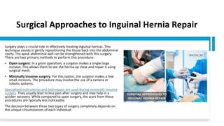 Understanding Inguinal Hernia - Complete Overview.pdf