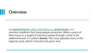 Understanding Inguinal Hernia - Complete Overview.pdf