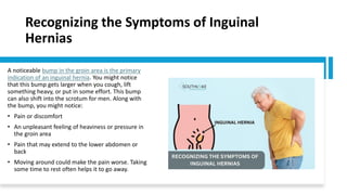 Understanding Inguinal Hernia - Complete Overview.pdf