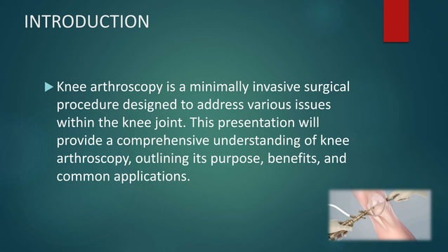 Understanding Knee Arthroscopy ppt.pptx | Physical Therapy | Wellness