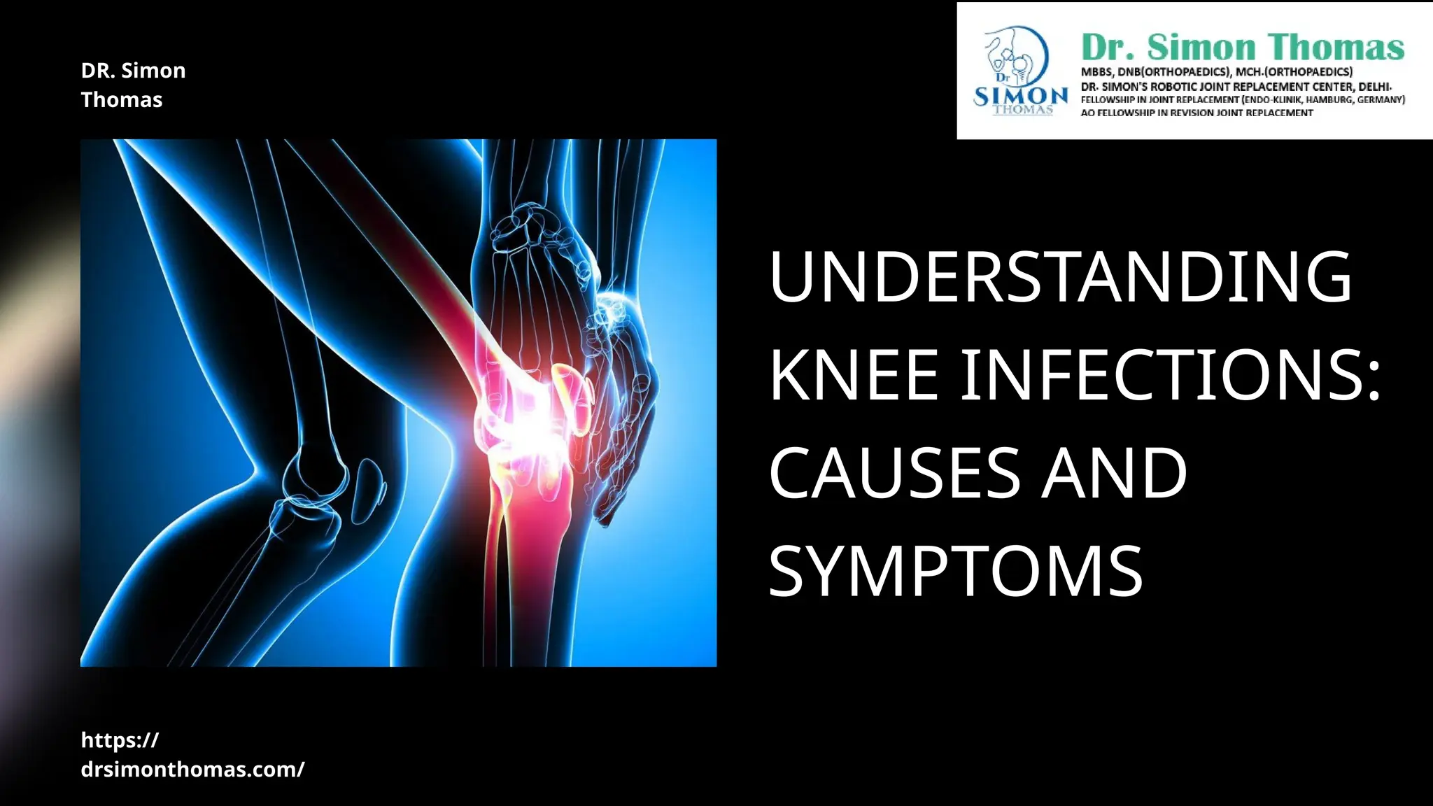 Understanding Knee Infections Causes and Symptoms.pptx