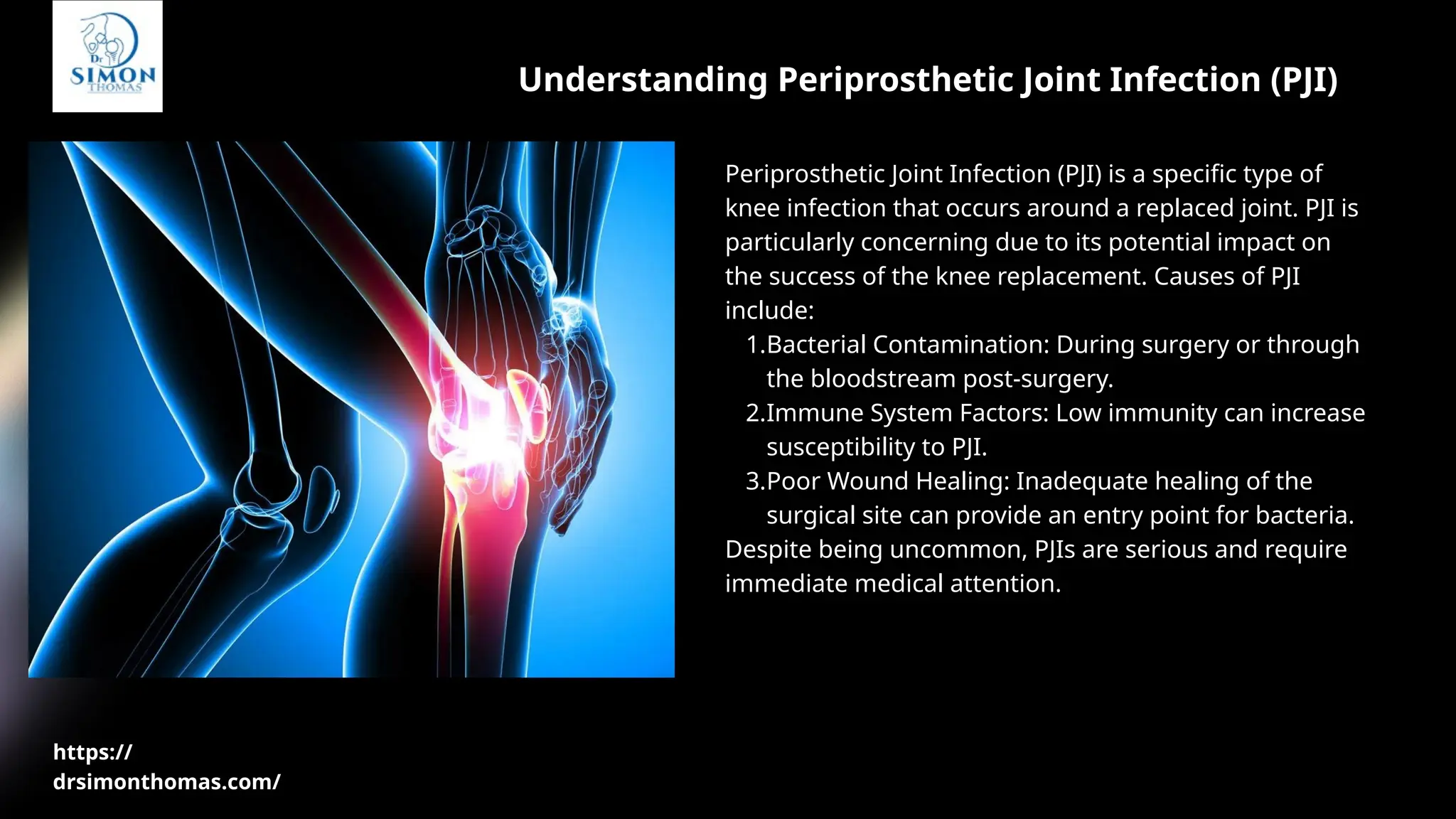 Understanding Knee Infections Causes and Symptoms.pptx