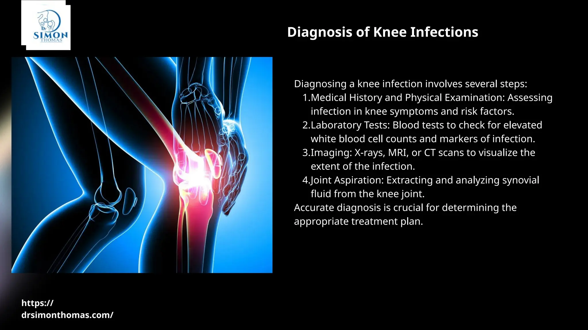 Understanding Knee Infections Causes and Symptoms.pptx | Bone and Joint ...