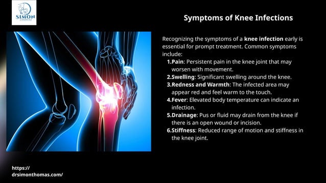Understanding Knee Infections Causes and Symptoms.pptx | Bone and Joint ...