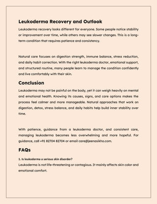 Understanding Leukoderma as a Skin Disorder.pdf