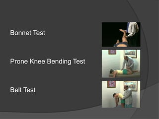 Understanding lumbar disc herniation | PPT