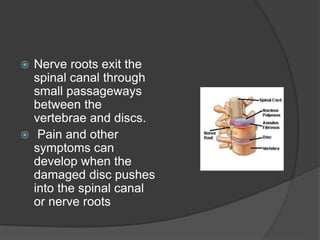 Understanding lumbar disc herniation | PPT