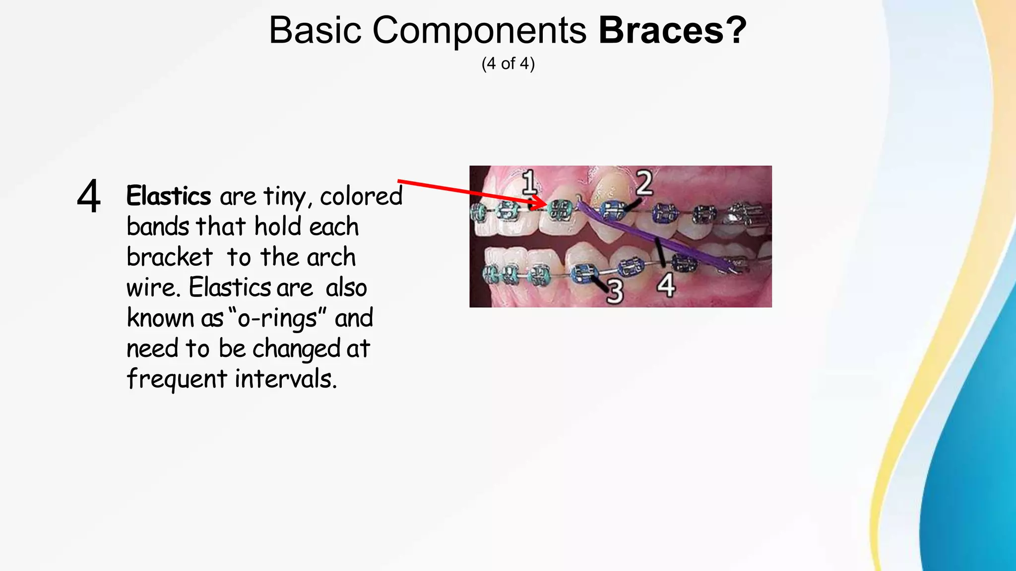 Understanding & maintaining dental braces shadyside orthodontic | PPT