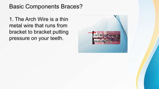 Understanding & maintaining dental braces shadyside orthodontic | PPT