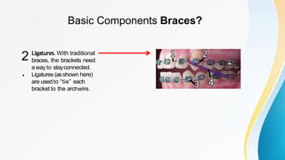 Understanding & maintaining dental braces shadyside orthodontic | PPTX