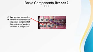 Understanding & maintaining dental braces shadyside orthodontic | PPTX