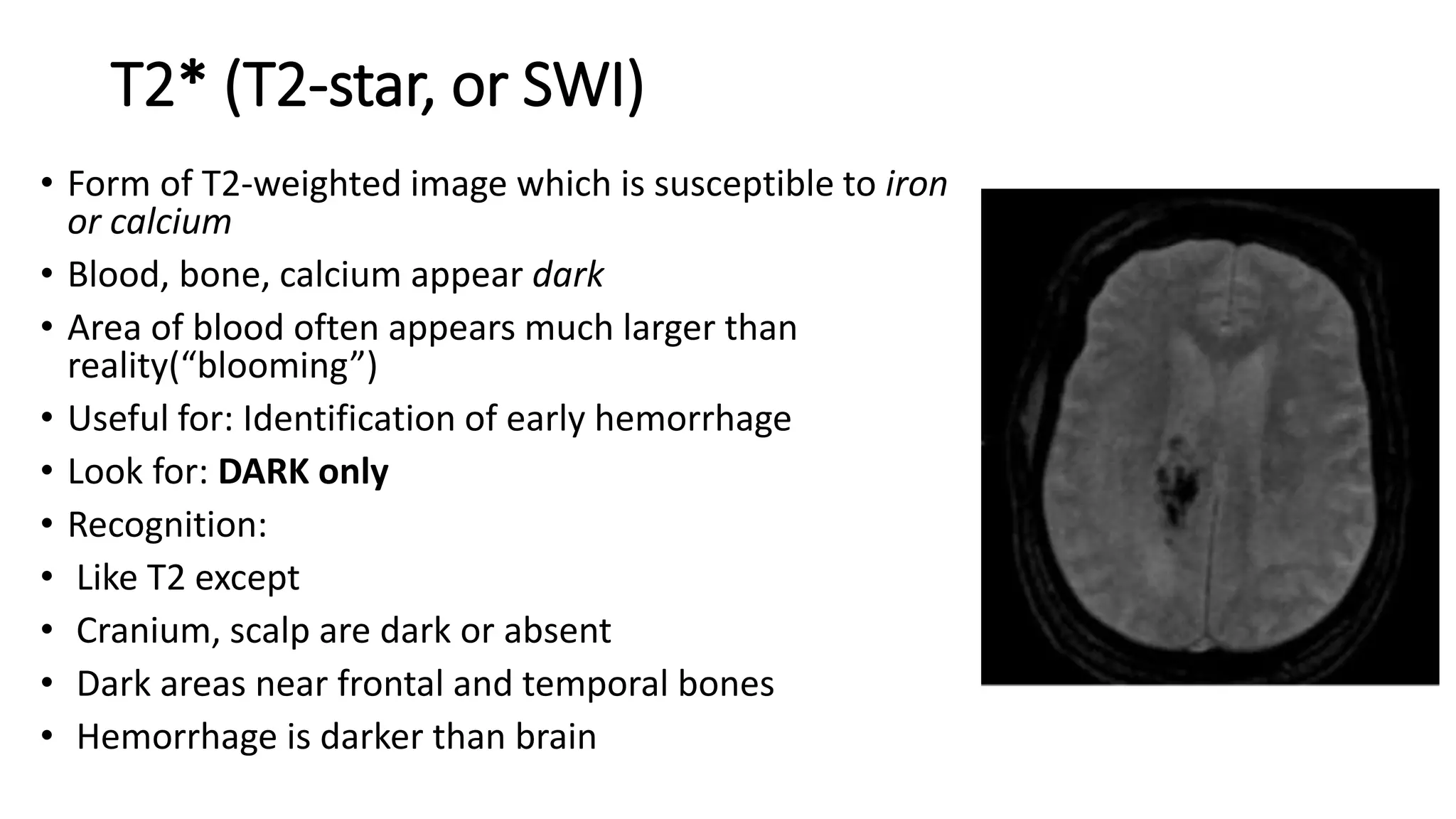 Understanding mri in neonate | PPTX
