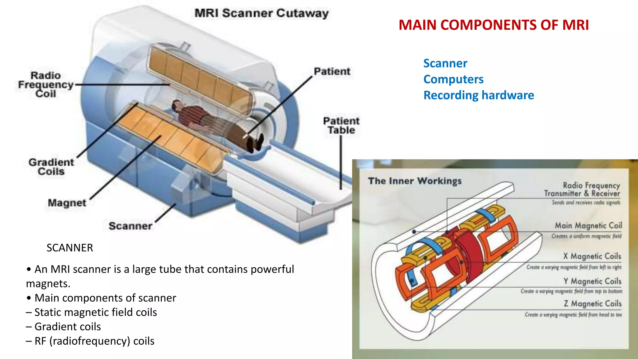 Understanding mri in neonate | PPTX