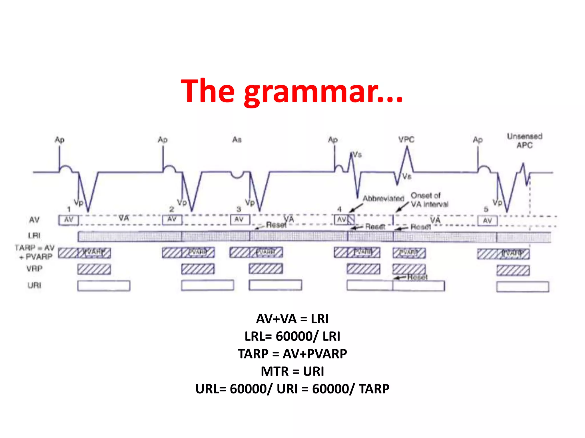 Understanding pacemakers | PPTX