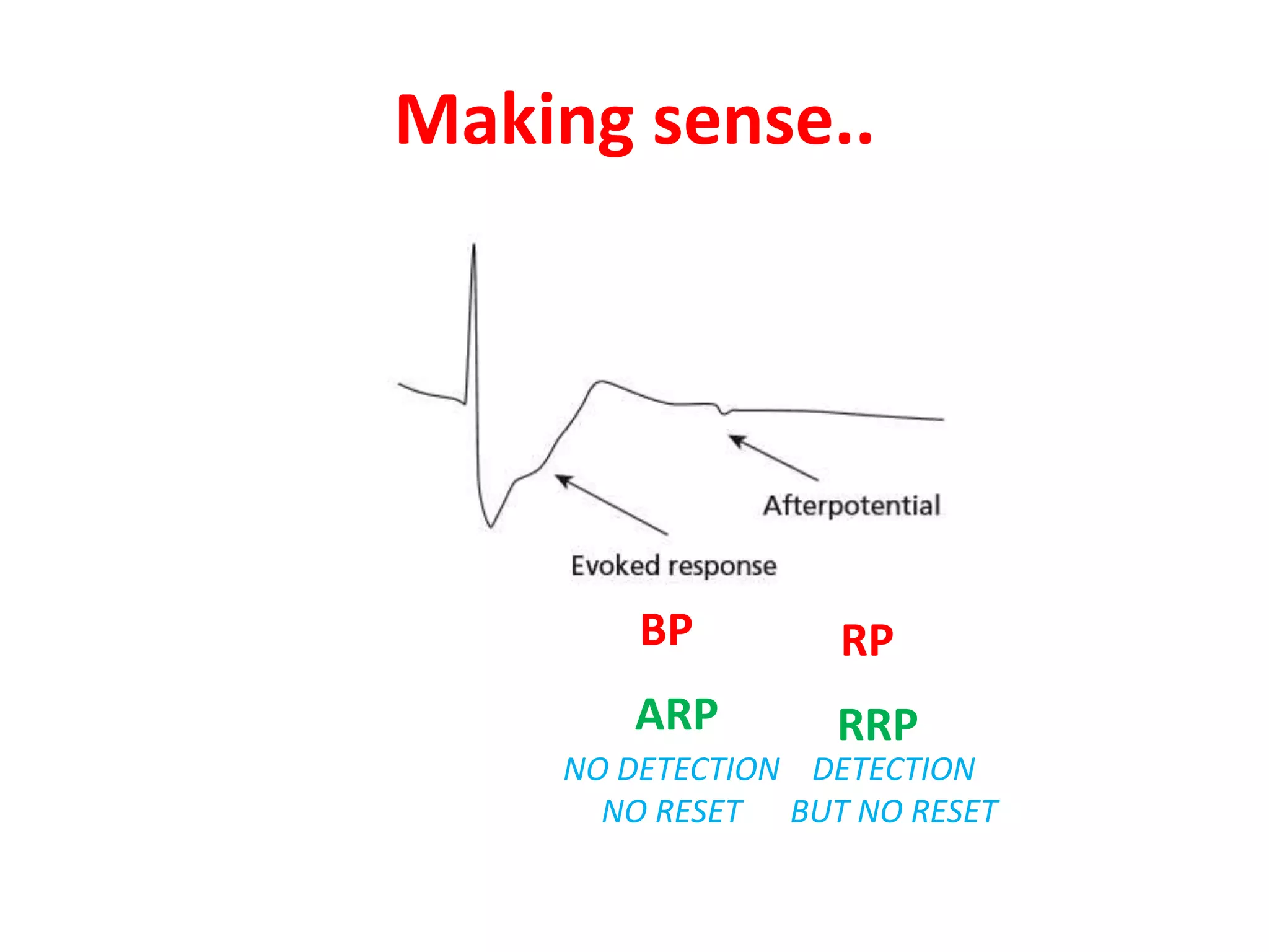 Understanding pacemakers | PPTX