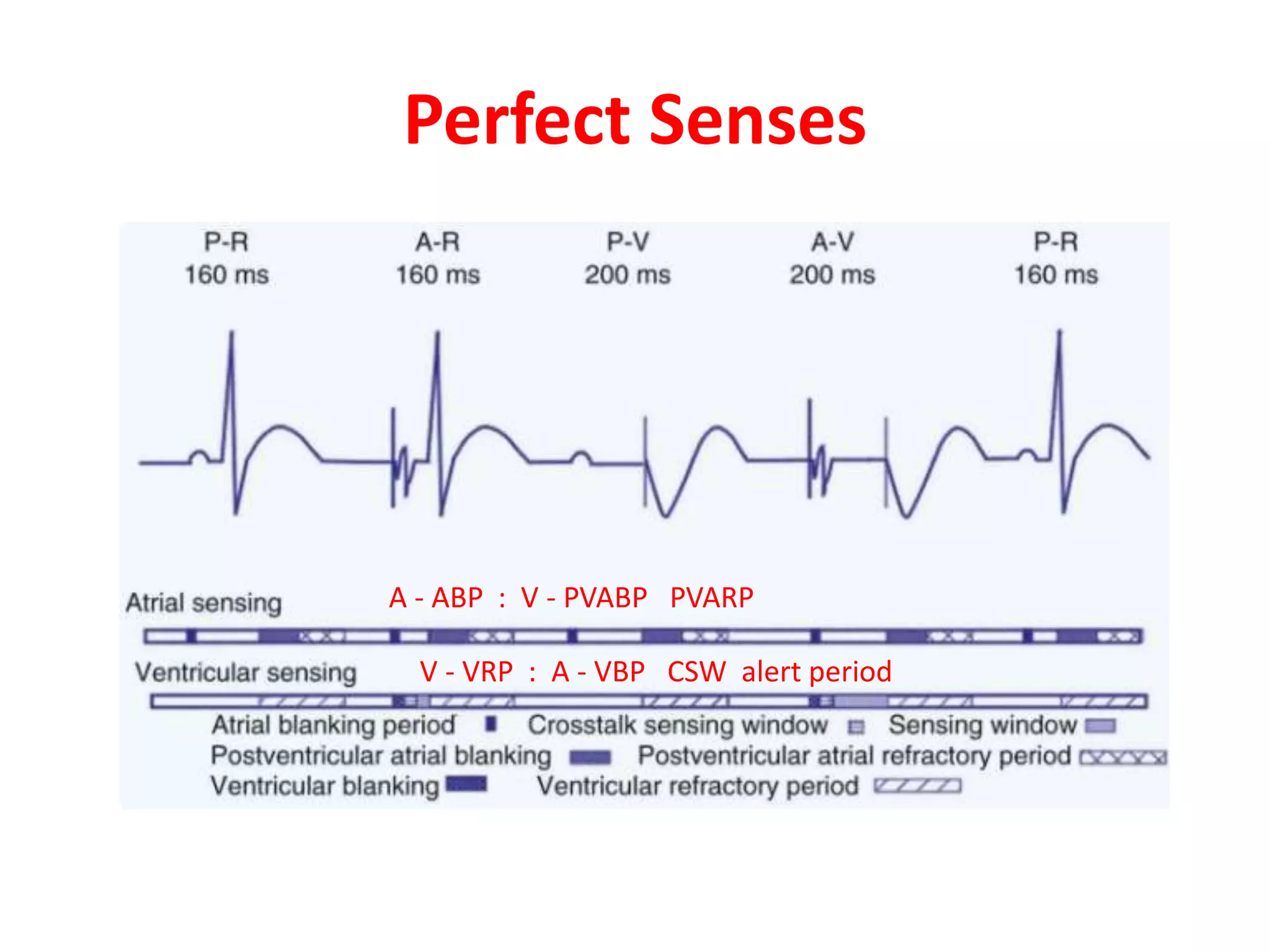 Understanding pacemakers | PPTX