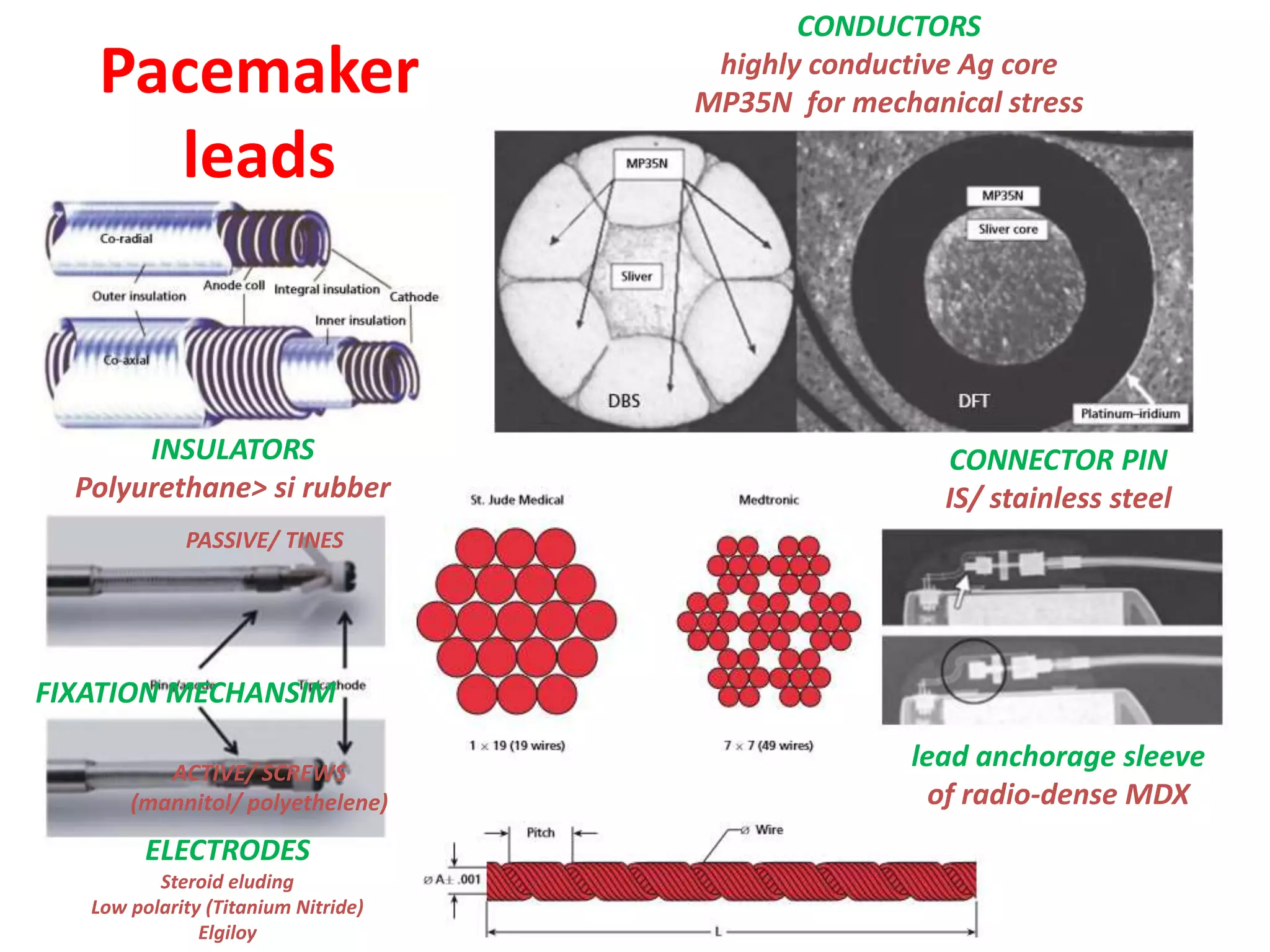 Understanding pacemakers | PPTX