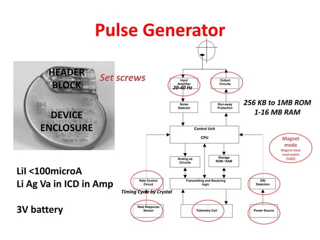 Understanding pacemakers | PPTX