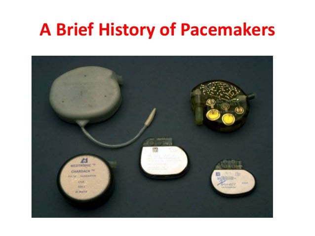 Understanding pacemakers