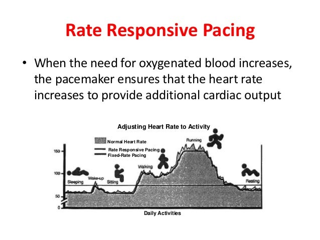 Understanding pacemakers