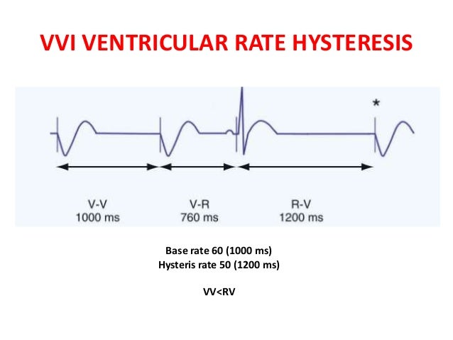 Understanding pacemakers
