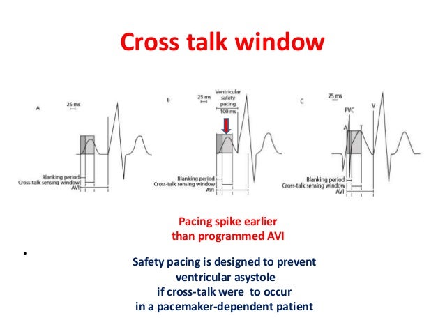 Understanding pacemakers