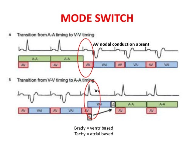 Understanding pacemakers