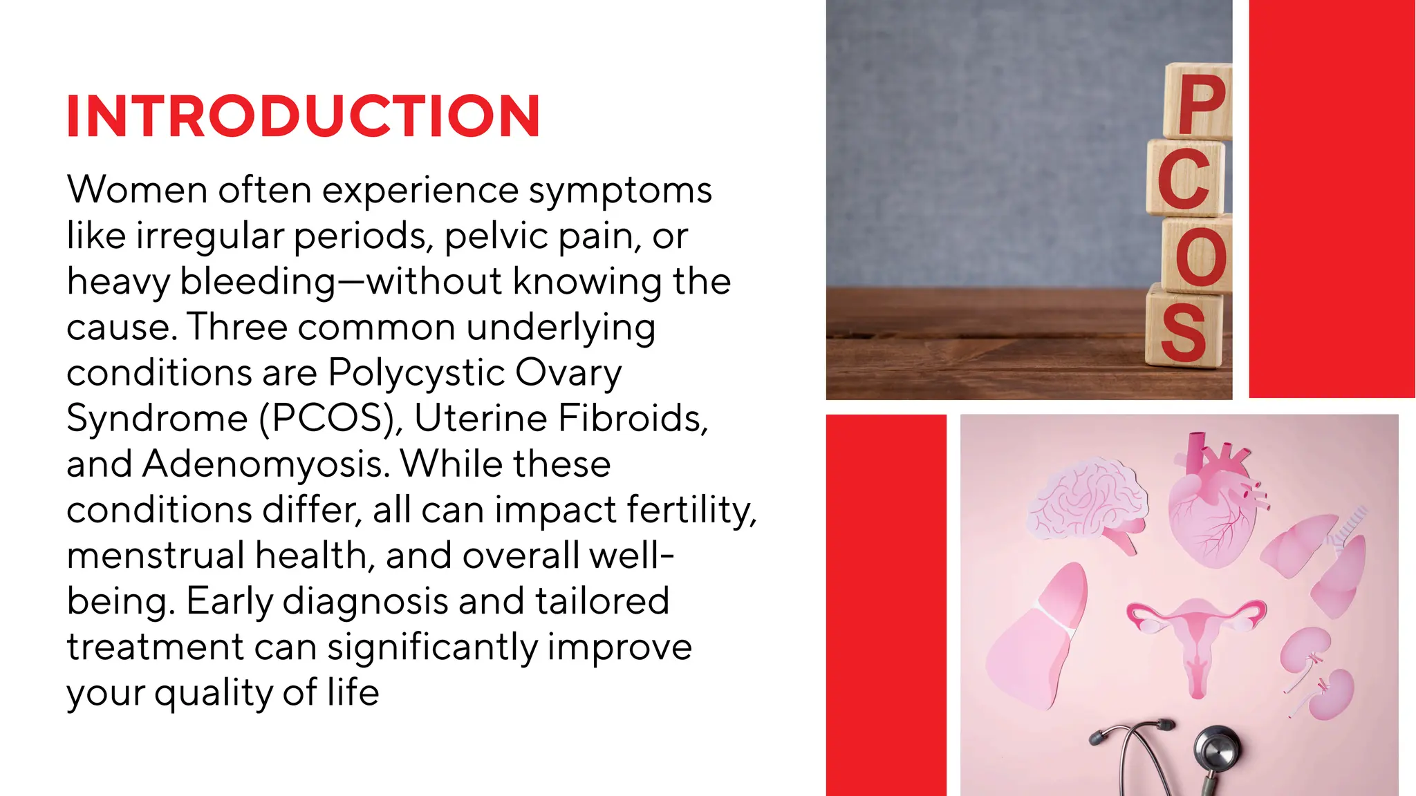 Understanding PCOS, Fibroids & Adenomyosis | PPT