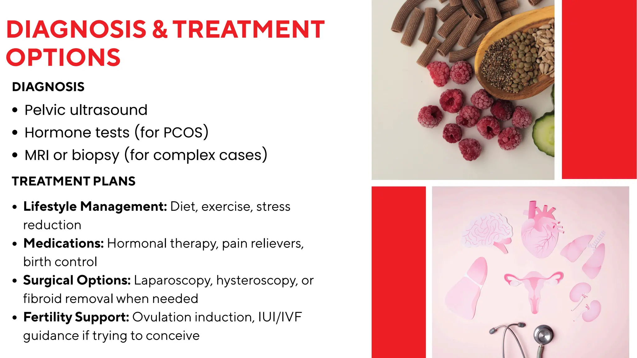 Understanding PCOS, Fibroids & Adenomyosis | PPT