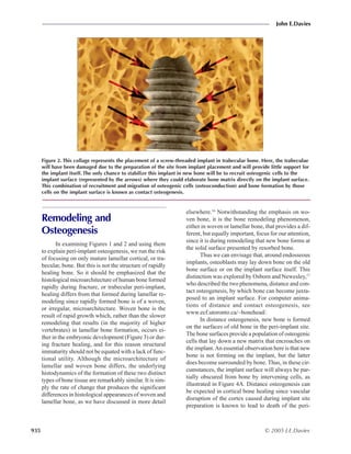 Understanding peri implant-endosseous_healing | PDF