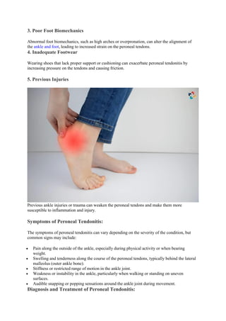 Peroneal Tendonitis: Causes, Symptoms, and Treatment Options | The ...