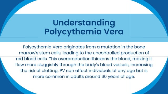 Polycythemia vera (PV) is a rare, chronic blood | PPT