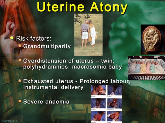 Understanding pph | PPT