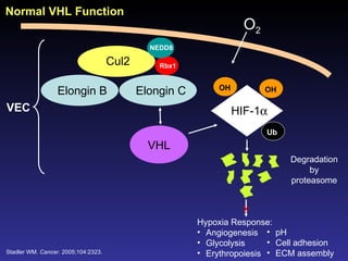 Understanding Renal Cell Carcinoma | PPT