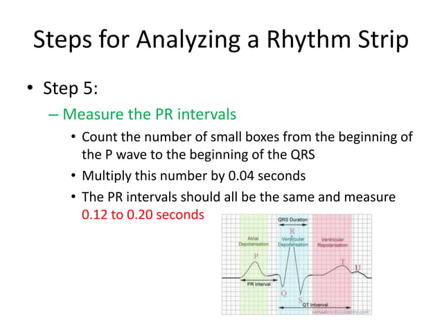 Understanding rhythm strips | PPTX | Heart and Cardiovascular Diseases ...