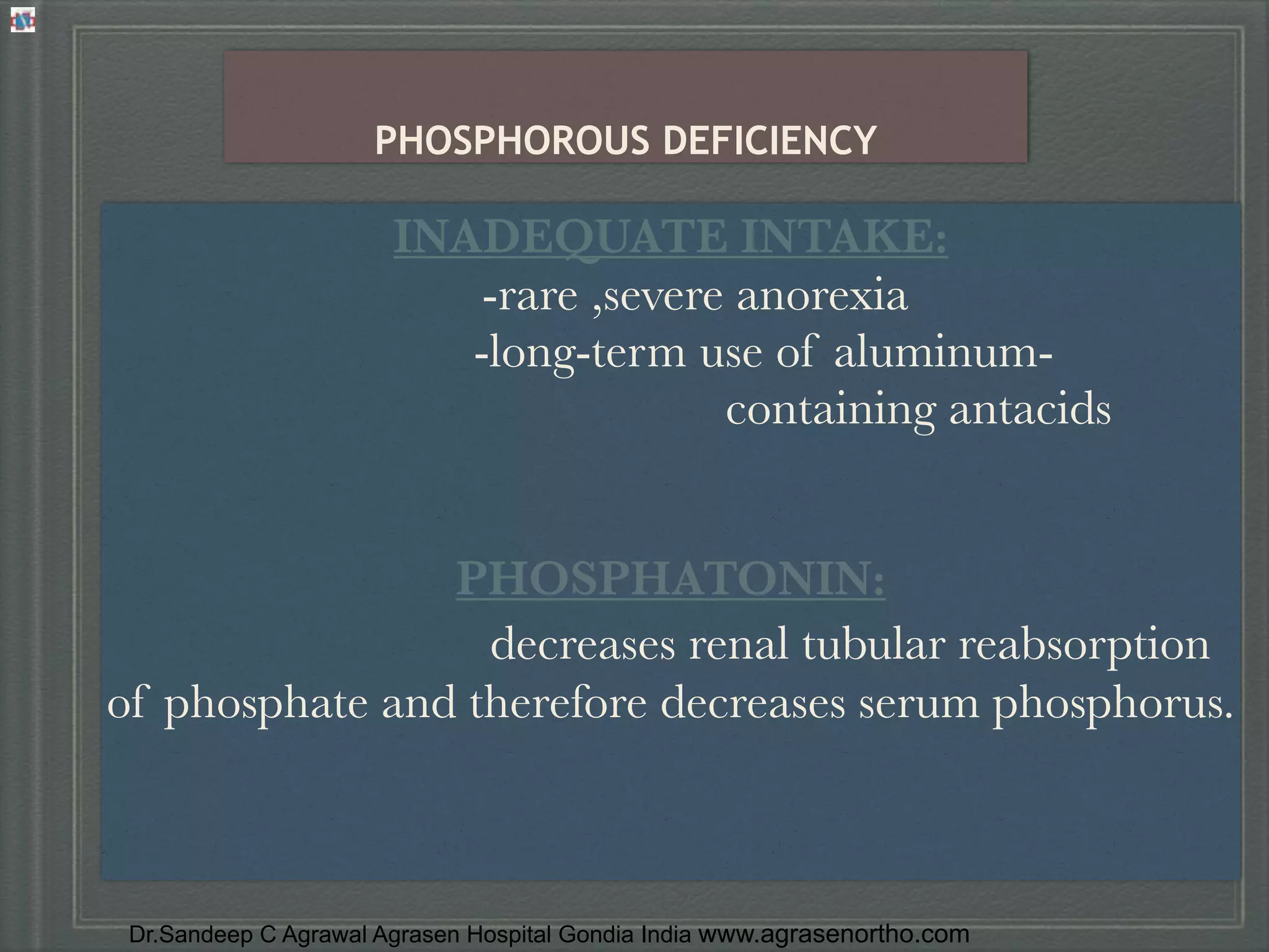 Understanding rickets types,diagnosis,prevention & treatment dr.sandeep ...
