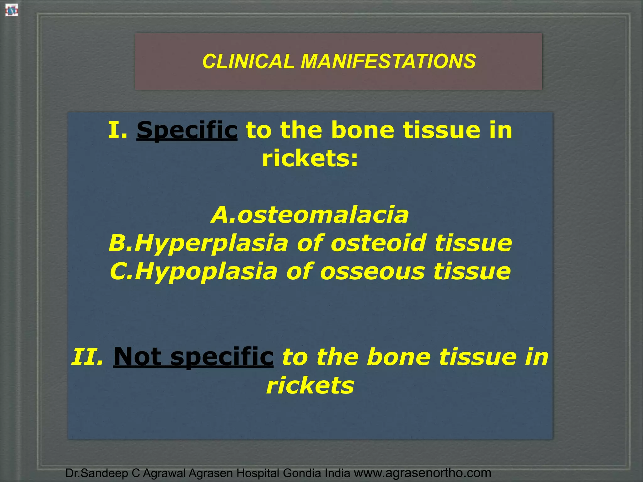 Understanding rickets types,diagnosis,prevention & treatment dr.sandeep ...