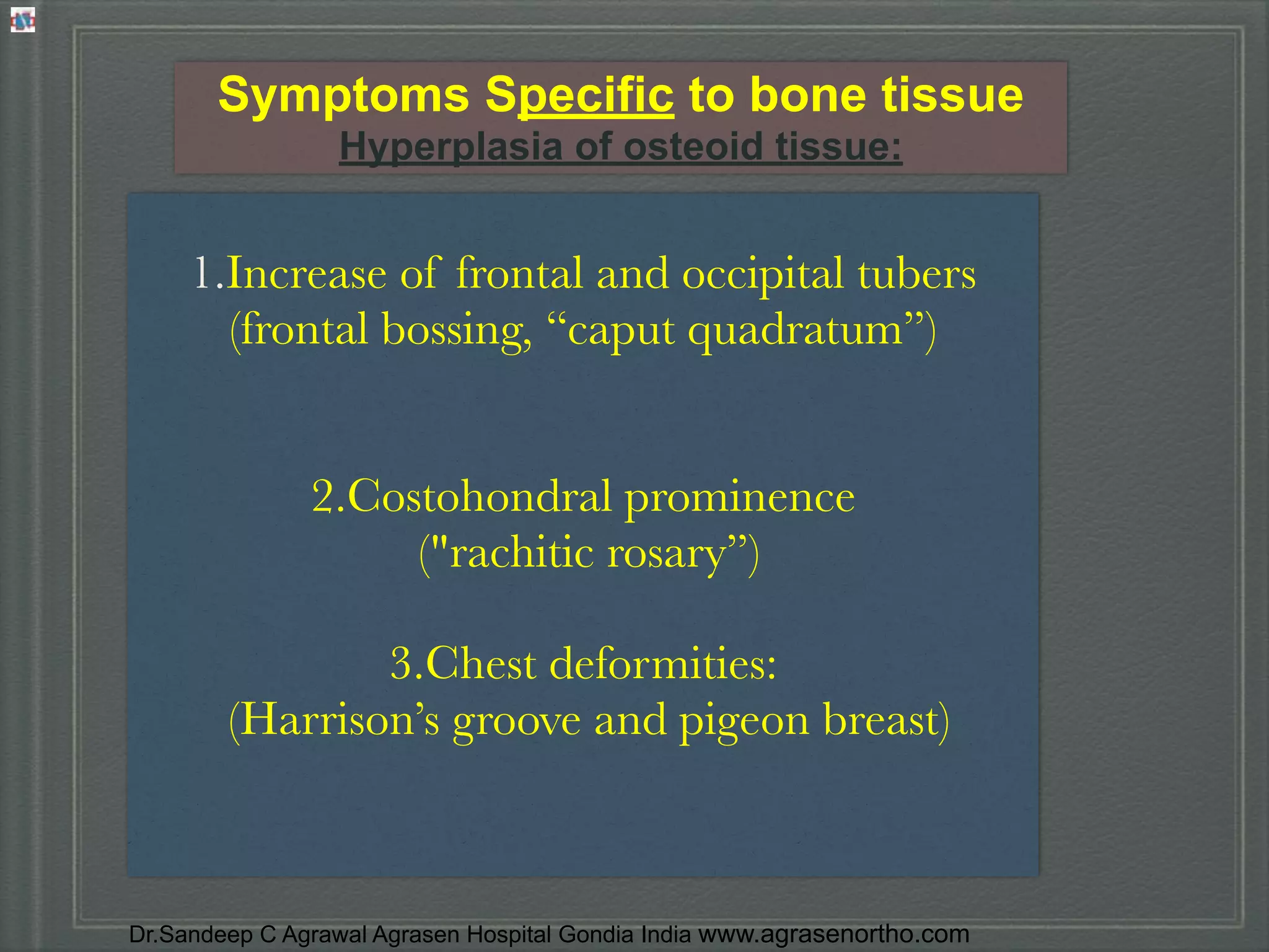 Understanding rickets types,diagnosis,prevention & treatment dr.sandeep ...
